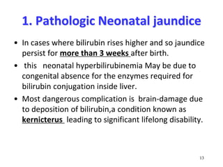 Jaundice.pptx
