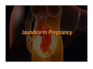 jaundice.pptx
