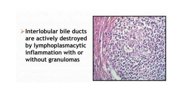 JAUNDICE.pptx, HEPATOBILIARY SYSTEM, PATHOLOGY | PPT