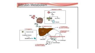 JAUNDICE.pptx, HEPATOBILIARY SYSTEM, PATHOLOGY | PPT
