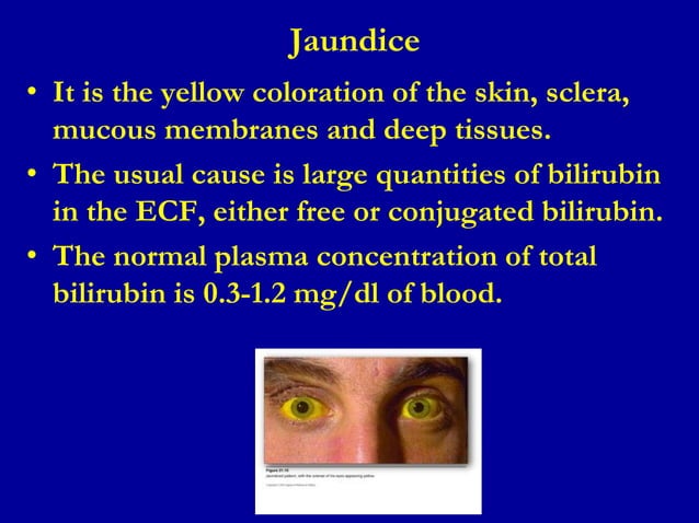JAUNDICE PRESENTATION FOR MEDICAL STUDENTS AROUND THE WORLD | PPT
