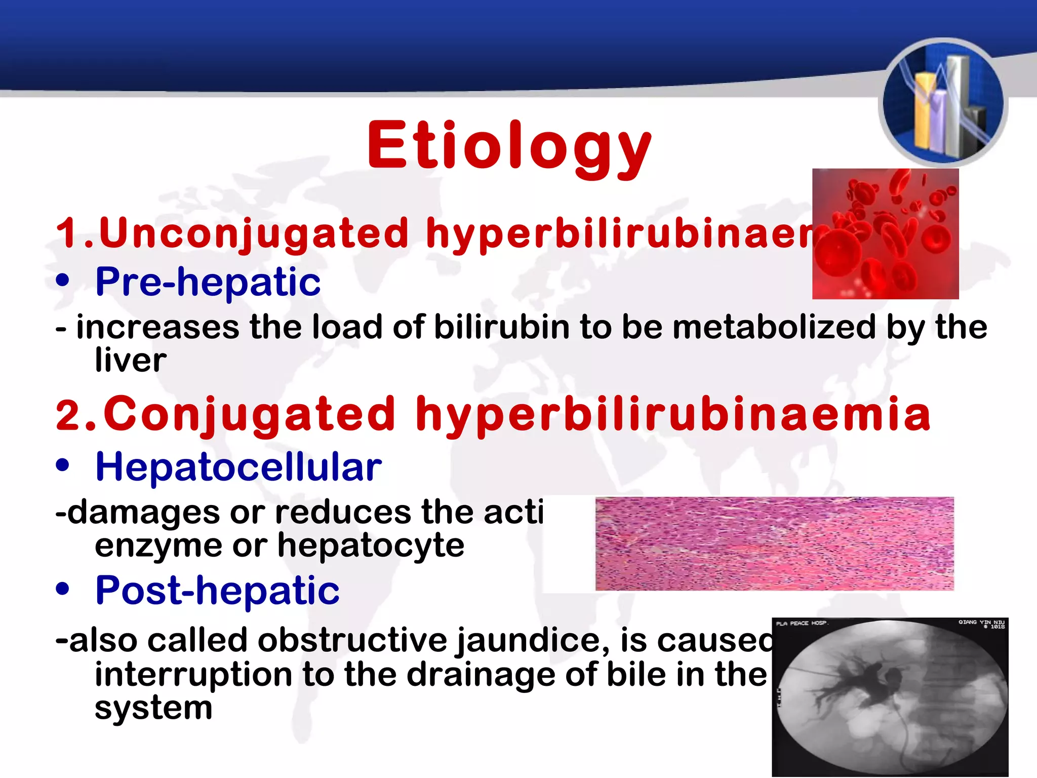 Jaundice By Dr. Kenny | PPT