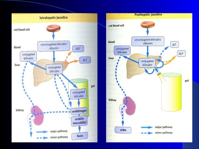 Jaundice - Liver Function Tests | PPT