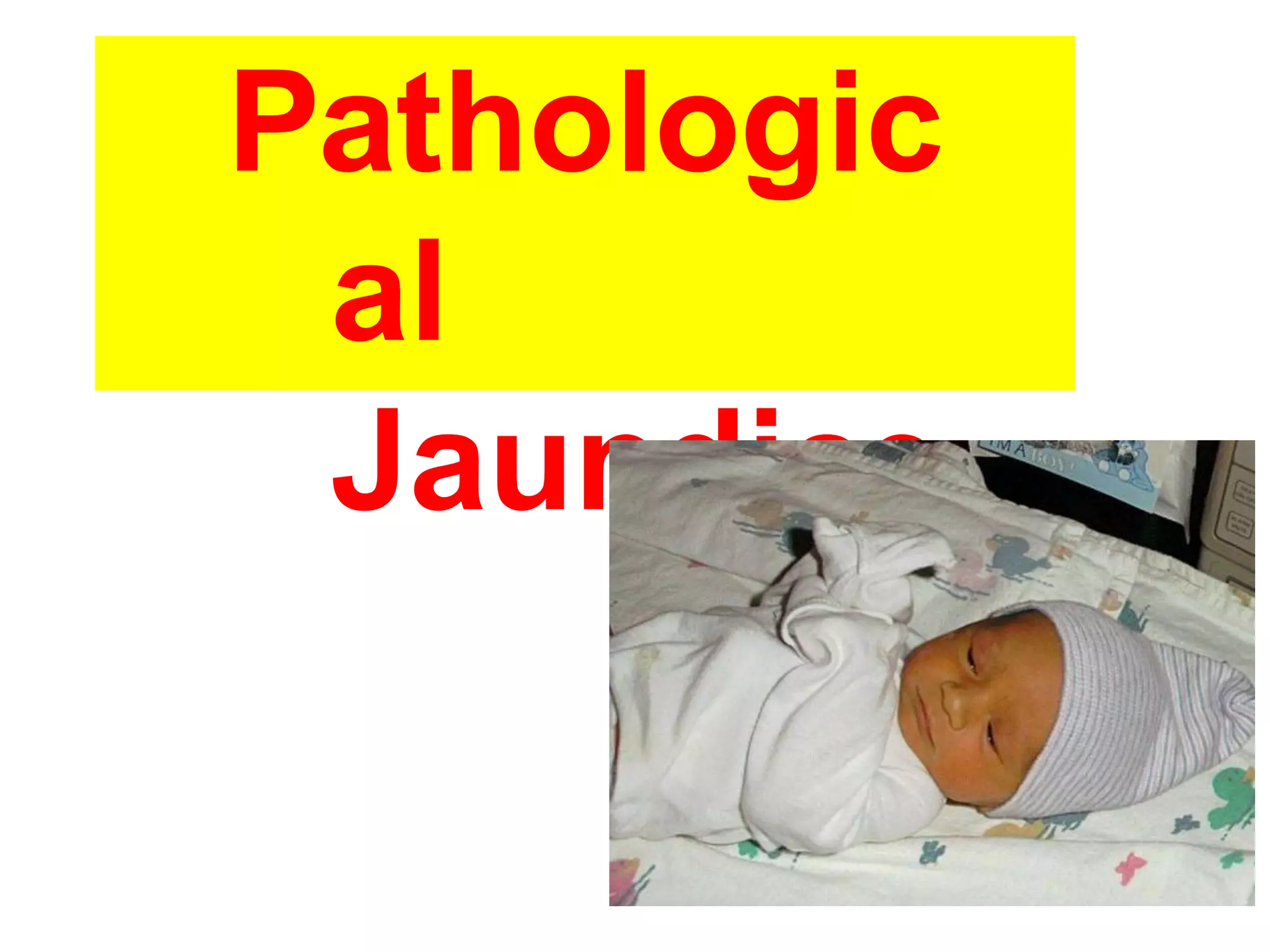jaundice-mnb.pptx