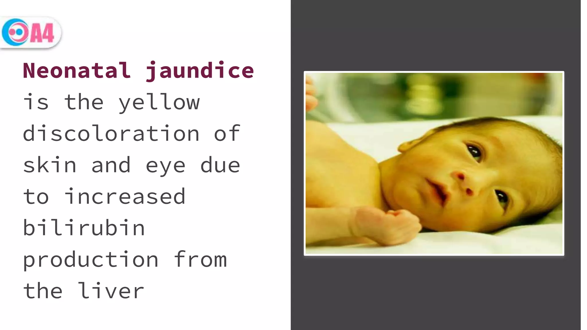 Jaundice myths and facts by a4 hospital | PPTX