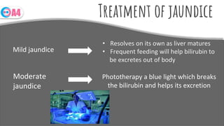 Jaundice myths and facts by a4 hospital | PPTX