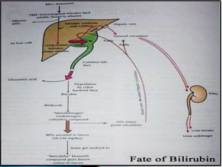 Jaundice and haemoglobinopathies | PPT