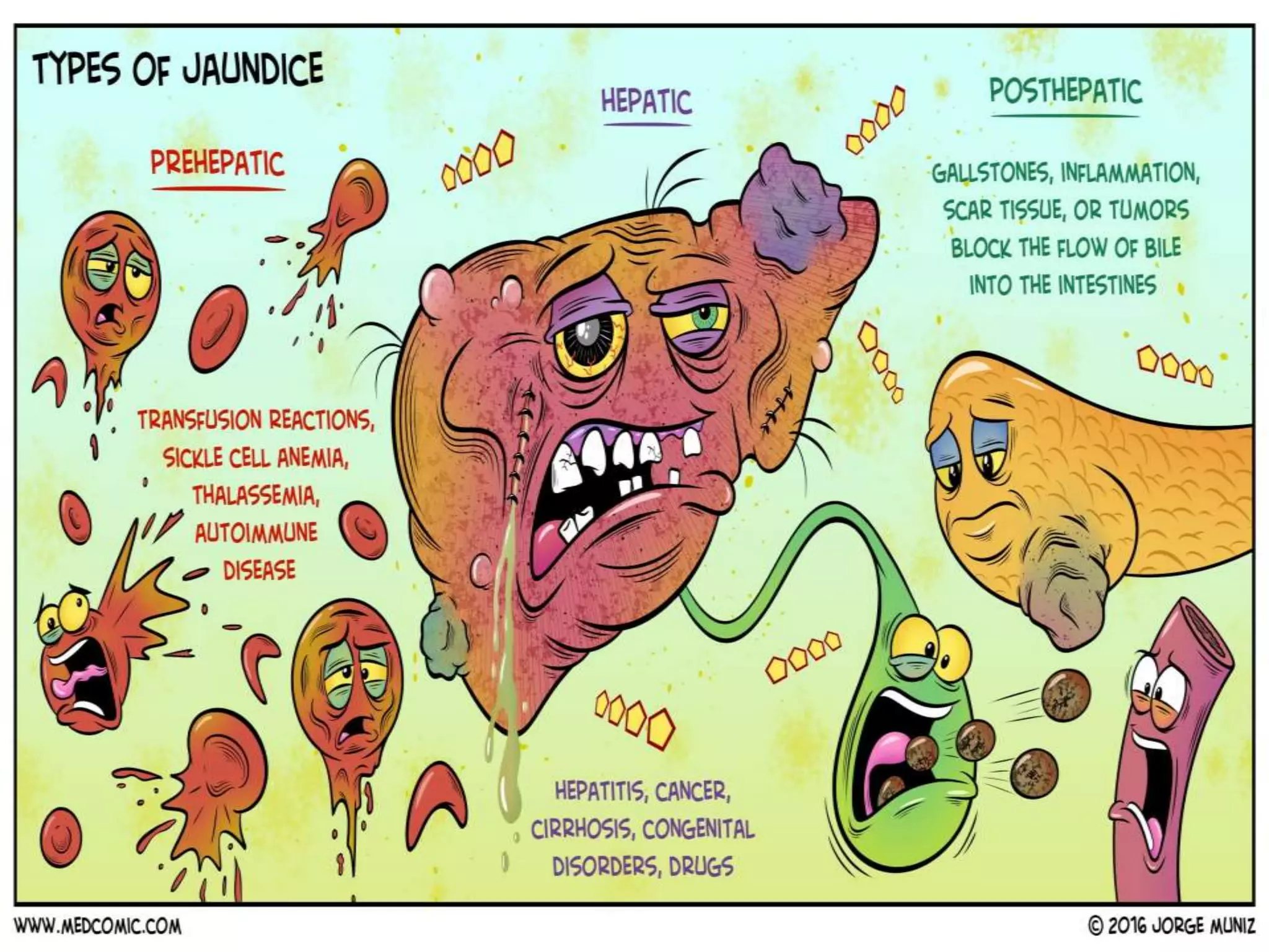Jaundice and hepatitis | PPT