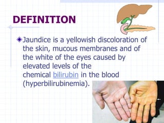 Jaundice and hepatitis | PPT