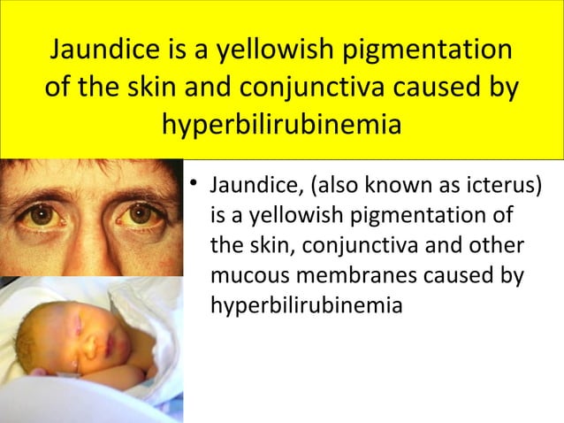Jaundice | PPT | Blood Disorders | Diseases and Conditions