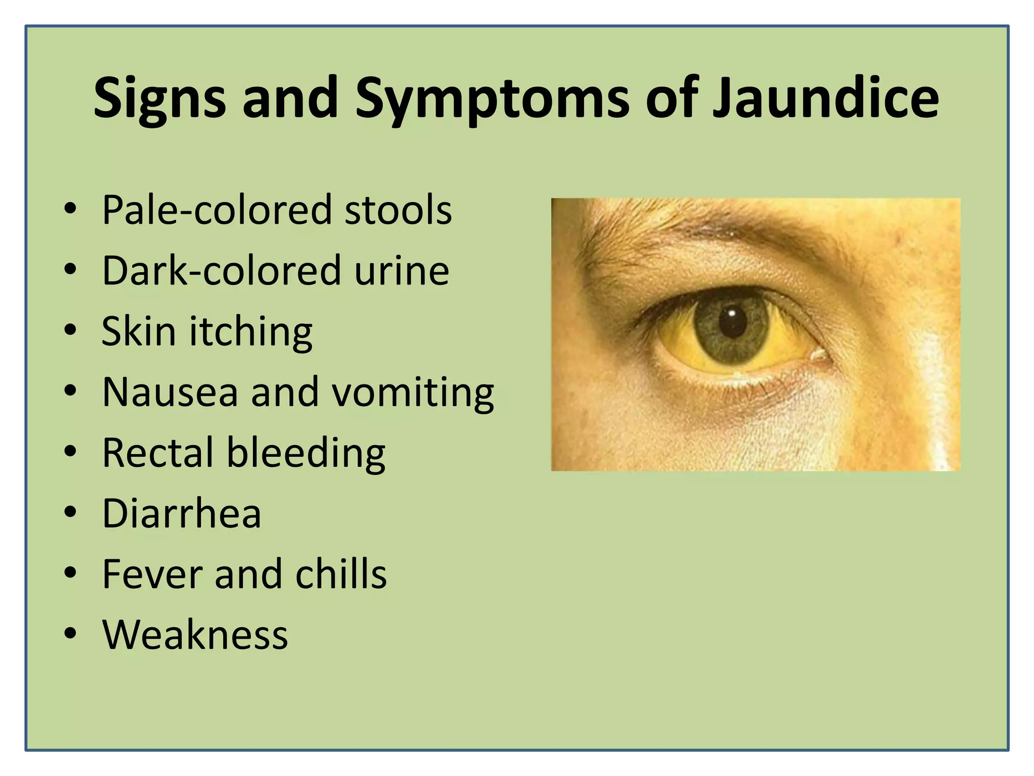 Jaundice and Liver Care Jaundinil Capsule | PPTX