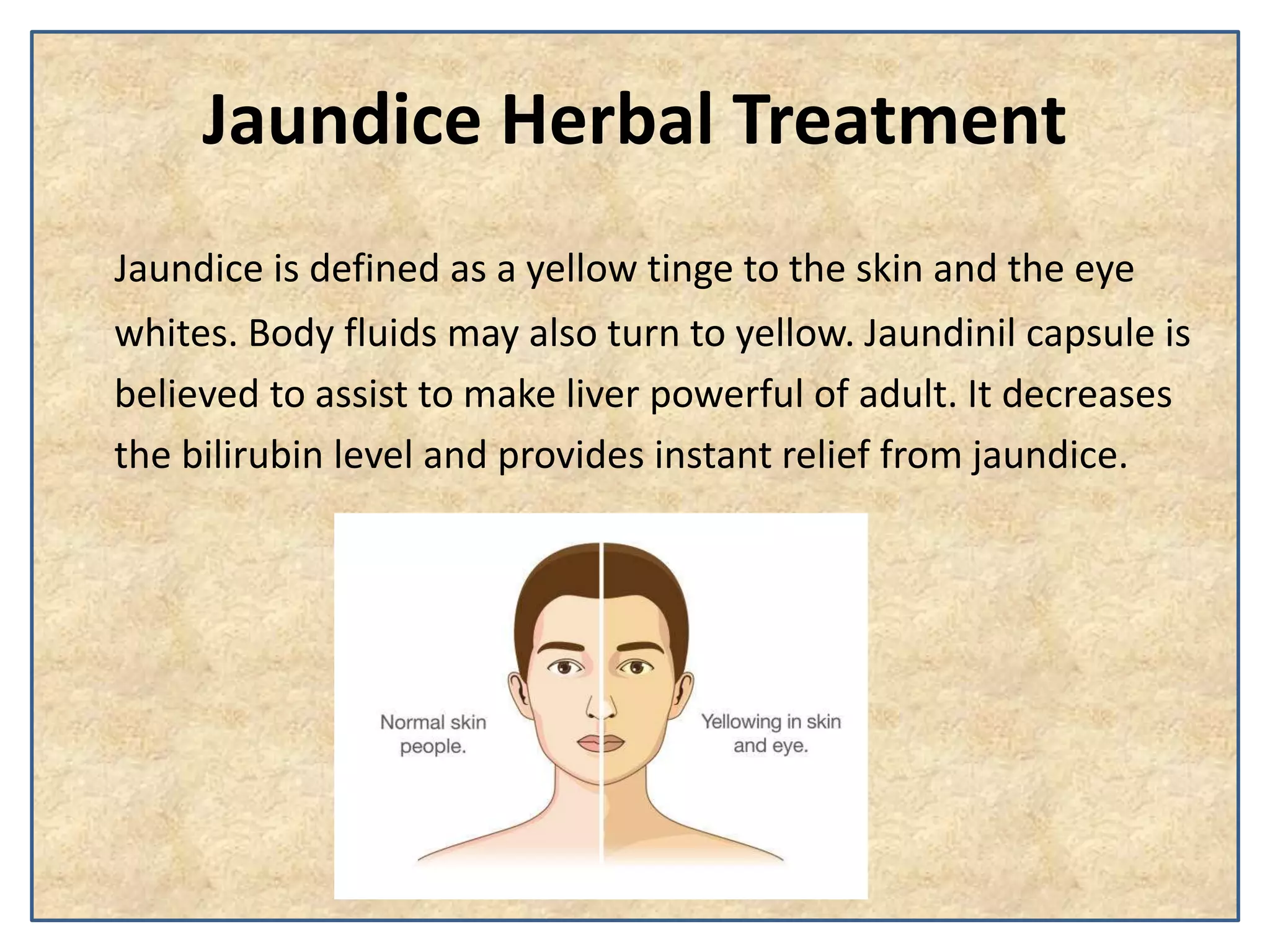 Jaundice Cure Treatment | PPTX