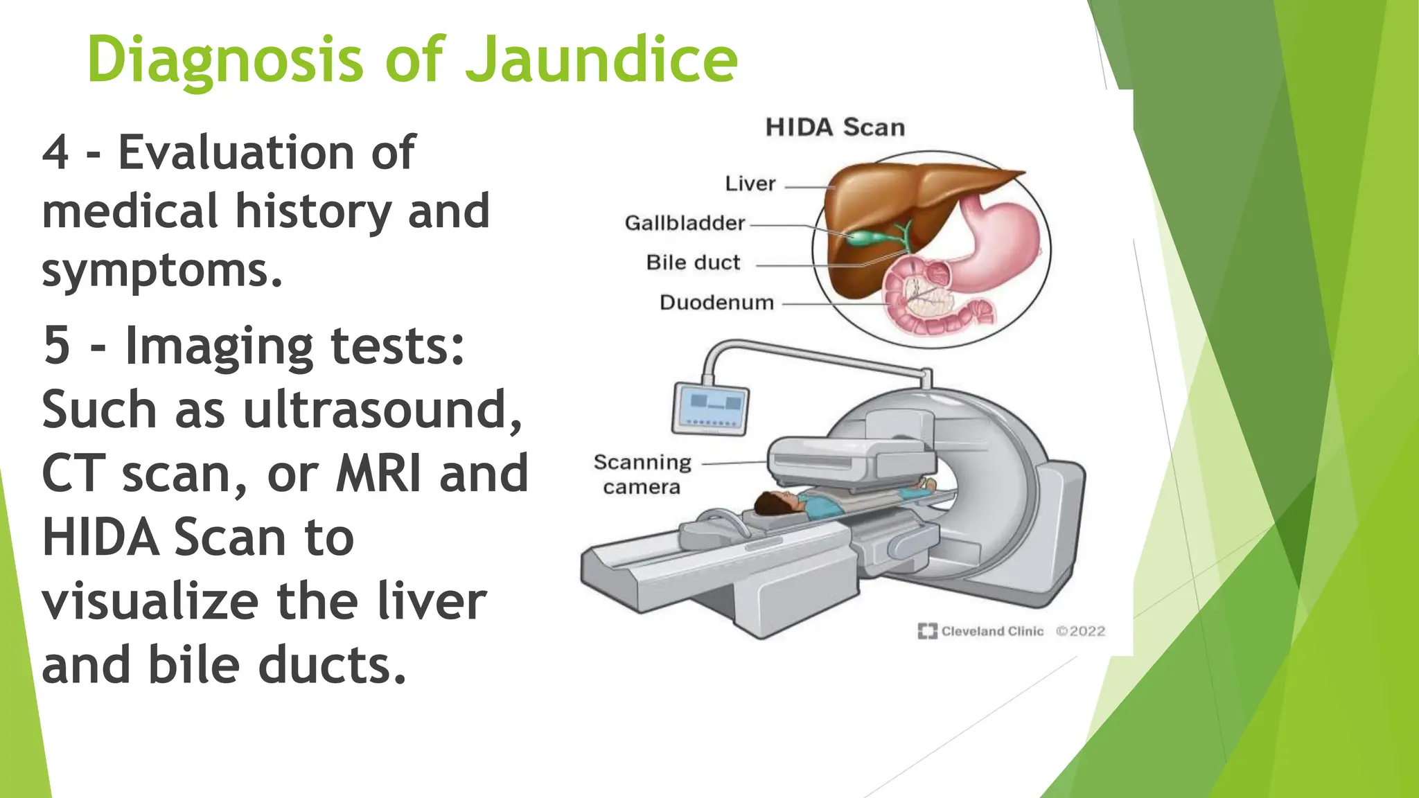 Jaundice :Definition, diagnosis, Causes. | PPT