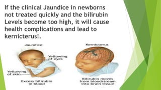 Jaundice :Definition, diagnosis, Causes. | PPTX