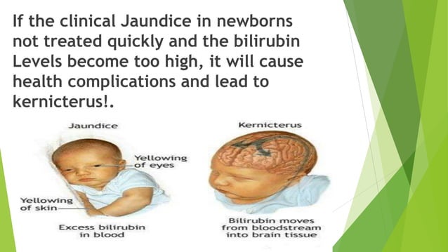 Jaundice :Definition, diagnosis, Causes. | PPTX