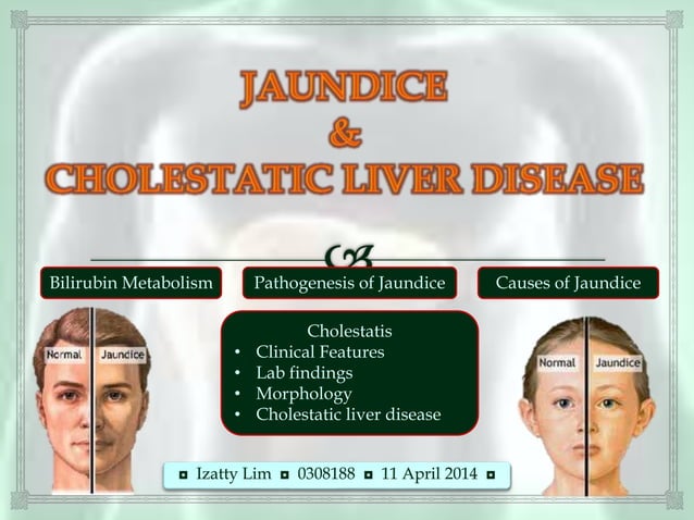 Jaundice & cholestatic liver diseases | PPTX