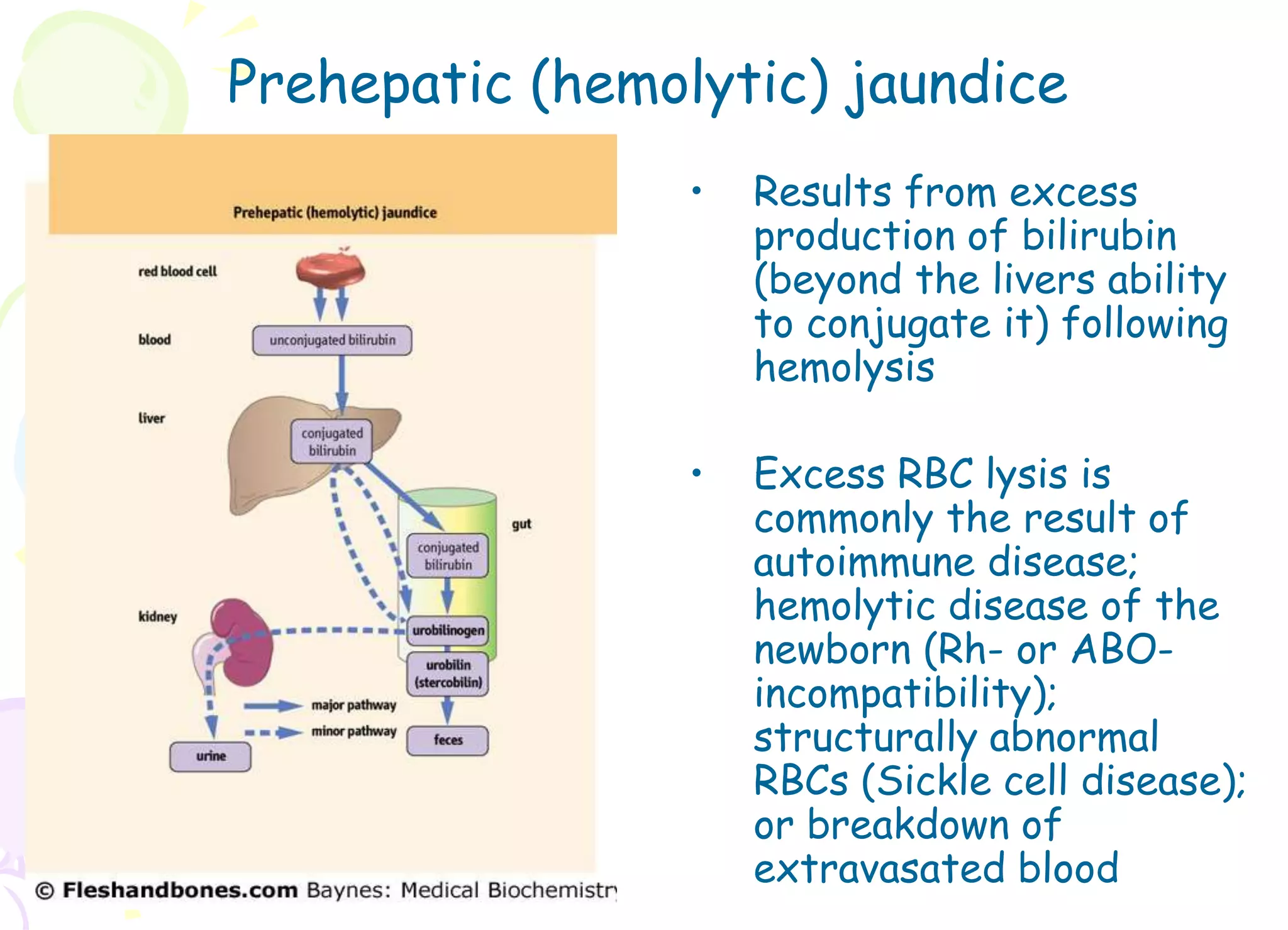 Jaundice - Etiology, pathogenesis, Clinical features, Investigation ...