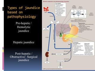 Jaundice general survey | PPTX