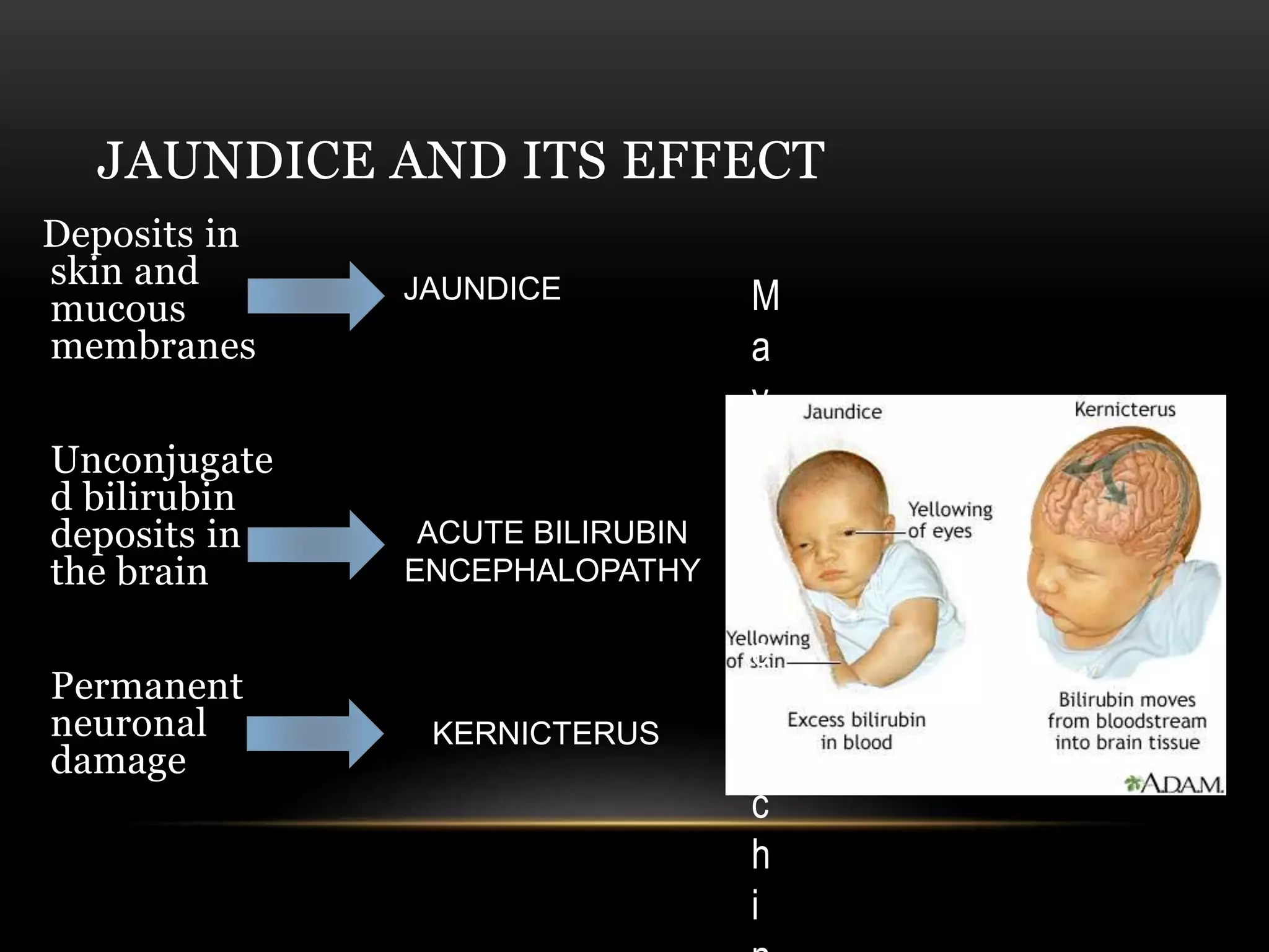 Jaundice in Children | PPTX