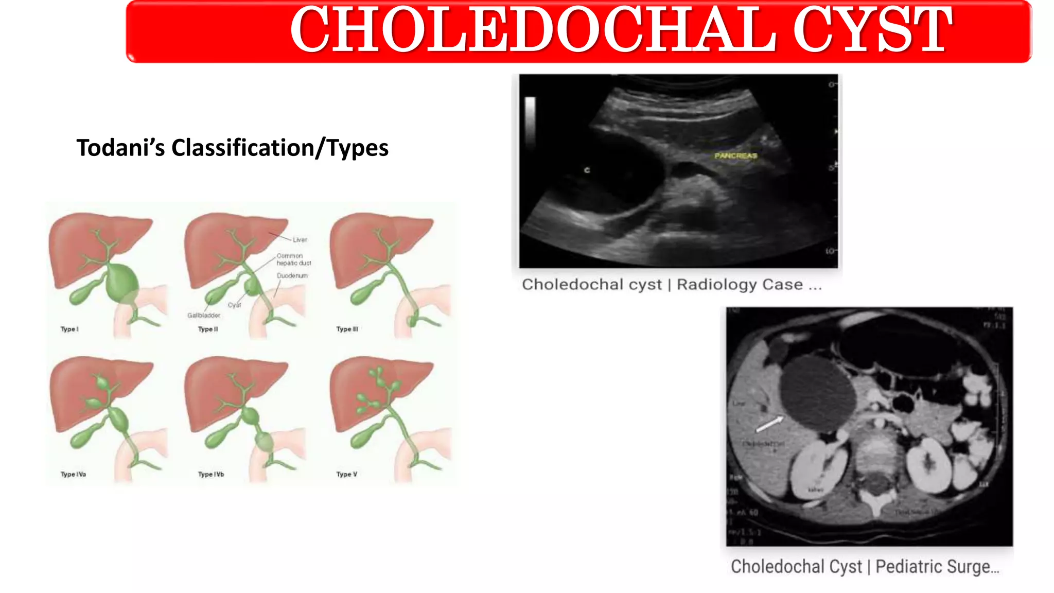JAUNDICE IN CHILDREN- Surgical Perspective.pptx