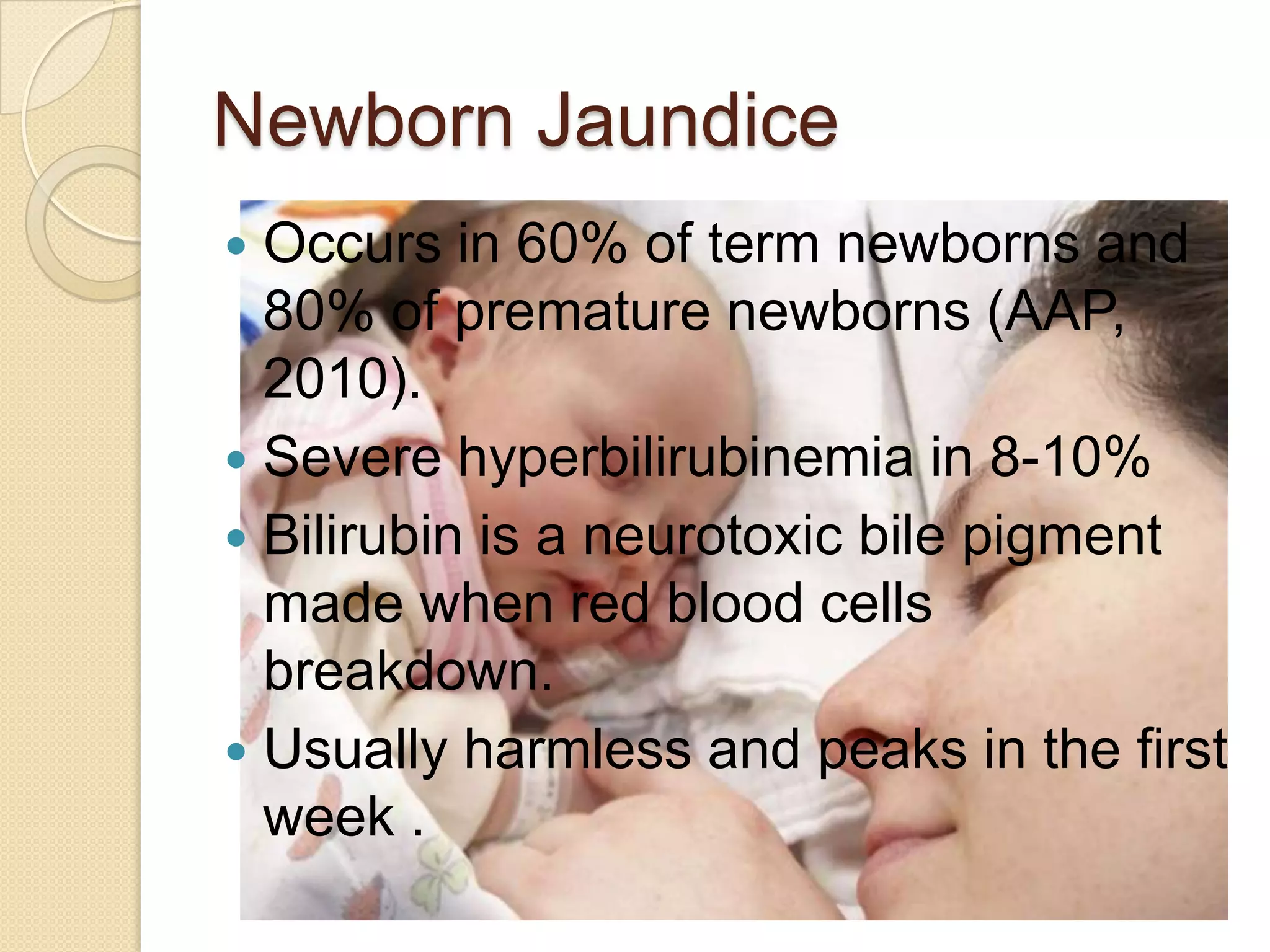 Jaundice in newborn | PPSX