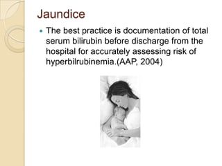 Jaundice in newborn | PPSX