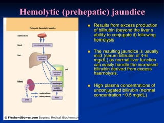 Jaundice (new).ppt | Digestive Disorders | Diseases and Conditions