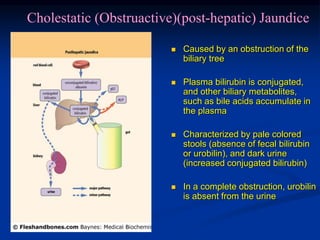 Jaundice (new).ppt