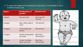 Jaundice of newborns.pptx