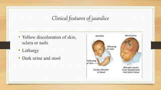 Neonatal Jaundice | PPTX