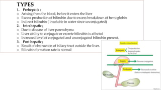 CASE PRESENTATION ON JAUNDICE | PPTX