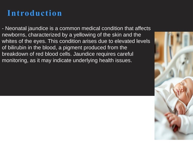 jaundice ppt finnal (1).pptxjfjfjfjfjfj | PPT