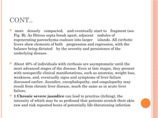 jaundice Presentation1.pptxhggvvbhhggvvb | PPT | Free Download