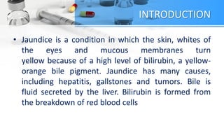 JAUNDICE | PPT