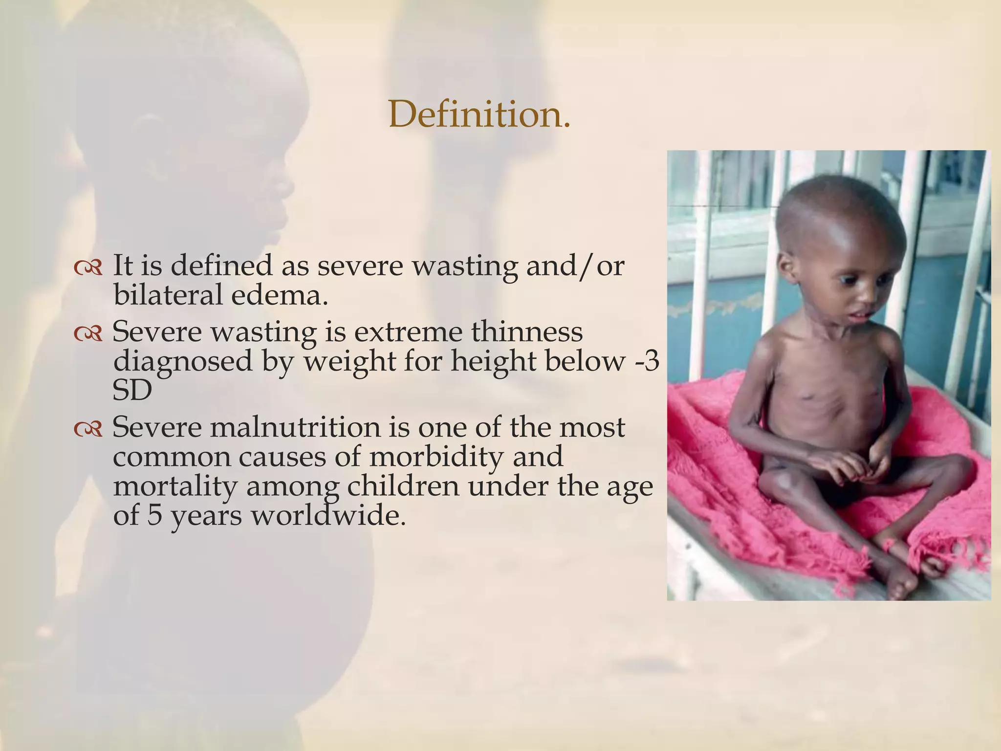 malnutrition classification and severe malnutrition management | PPTX