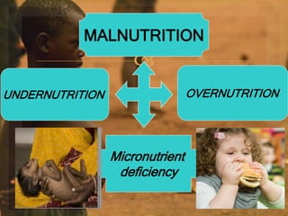 malnutrition classification and severe malnutrition management | PPTX