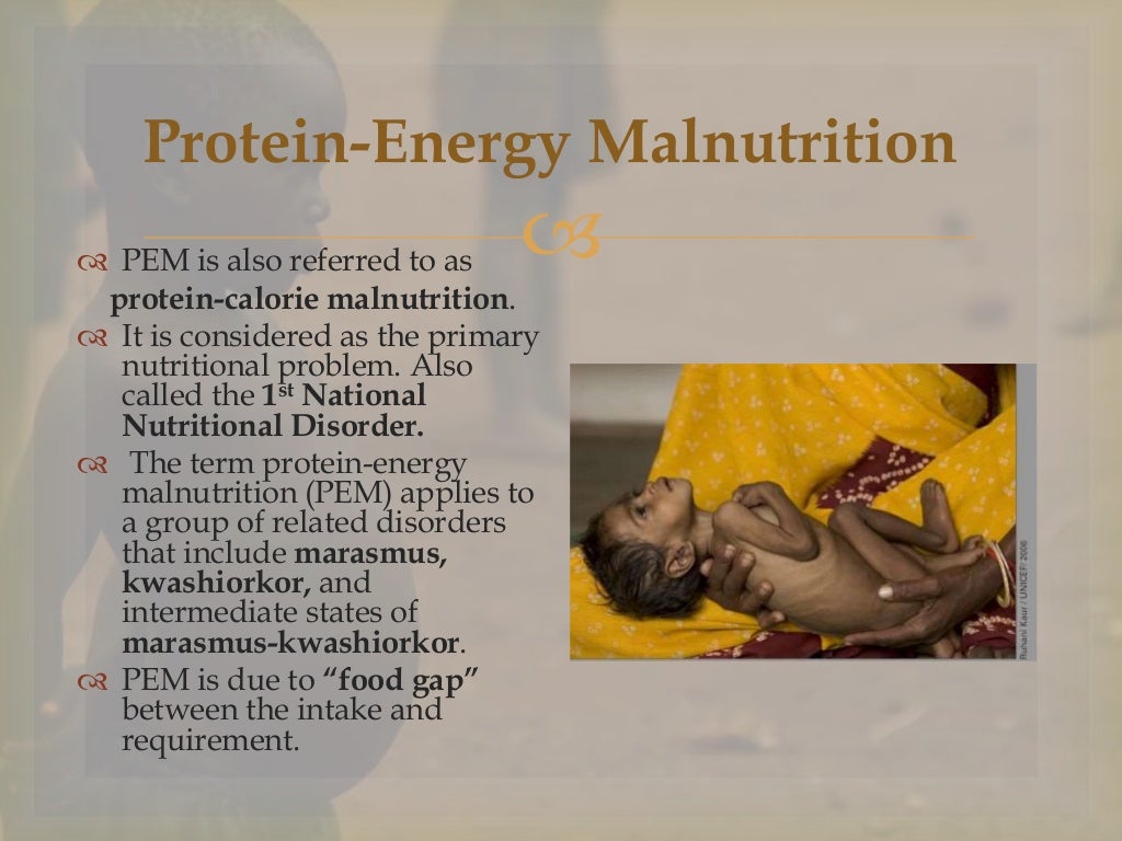 malnutrition classification and severe malnutrition management