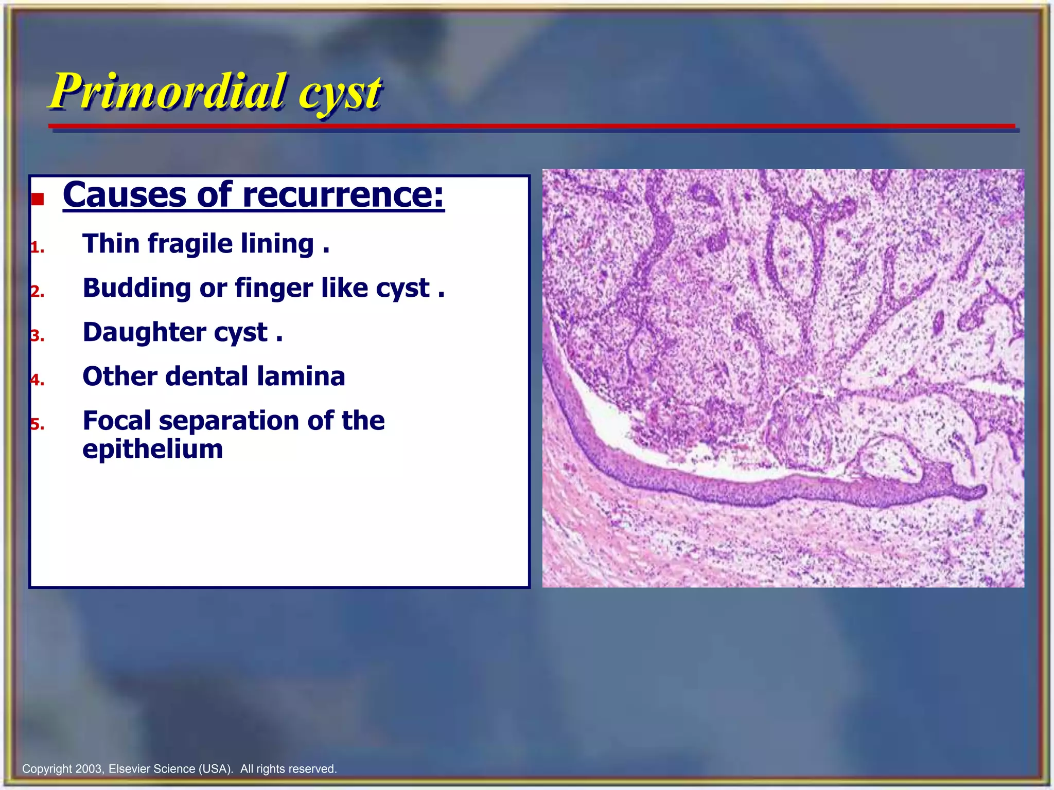Jaw bone cyst | PPTX