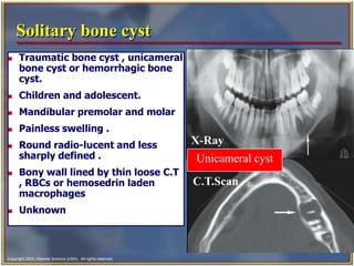 Jaw bone cyst | PPTX