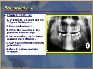Primordial Cyst