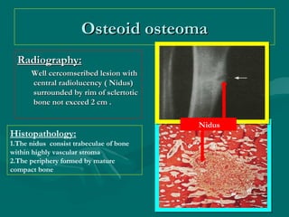 Jaw bone disaese ii | PPT