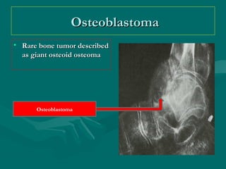 Jaw bone disaese ii | PPT