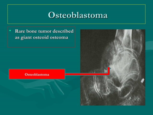 Jaw bone disaese ii | PPT | Bone and Joint Conditions | Diseases and ...