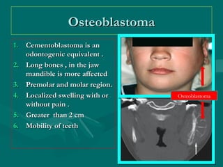 Jaw bone disaese ii | PPT