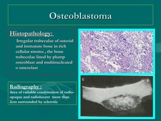 Jaw bone disaese ii | PPT