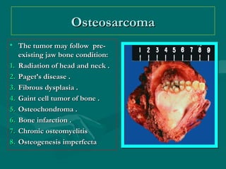 Jaw bone disaese ii | PPT