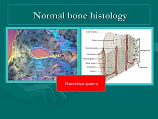Jaw bone disaese ii | PPT