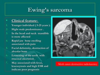 Jaw bone disaese ii | PPT