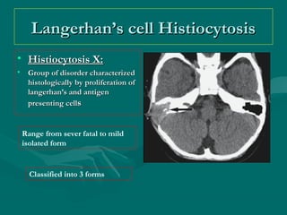 Jaw bone disaese ii | PPT