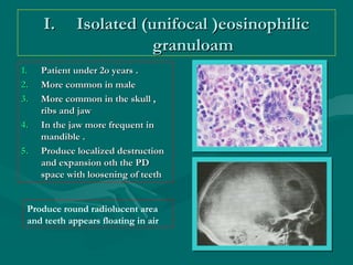 Jaw bone disaese ii | PPT